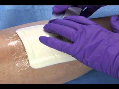 Shop for Wholesale Advanced Wound Care | MDS Associates